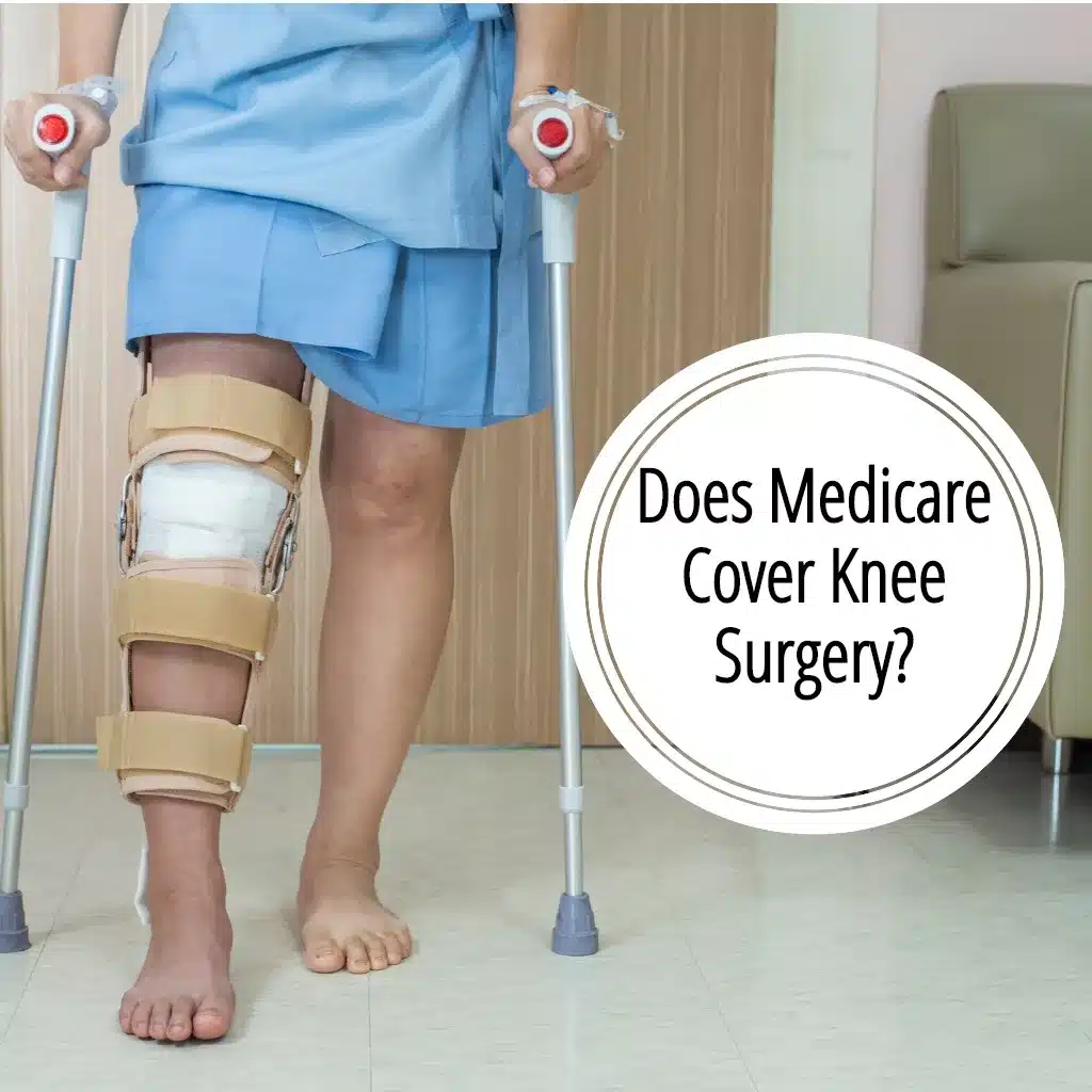 Does Medicare Cover Knee Replacement Surgery EZ Insure